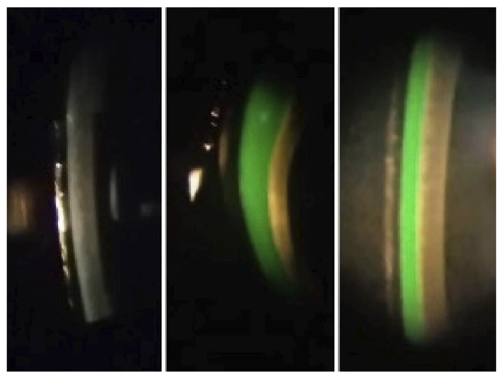 Case Nezar – Spectrum International